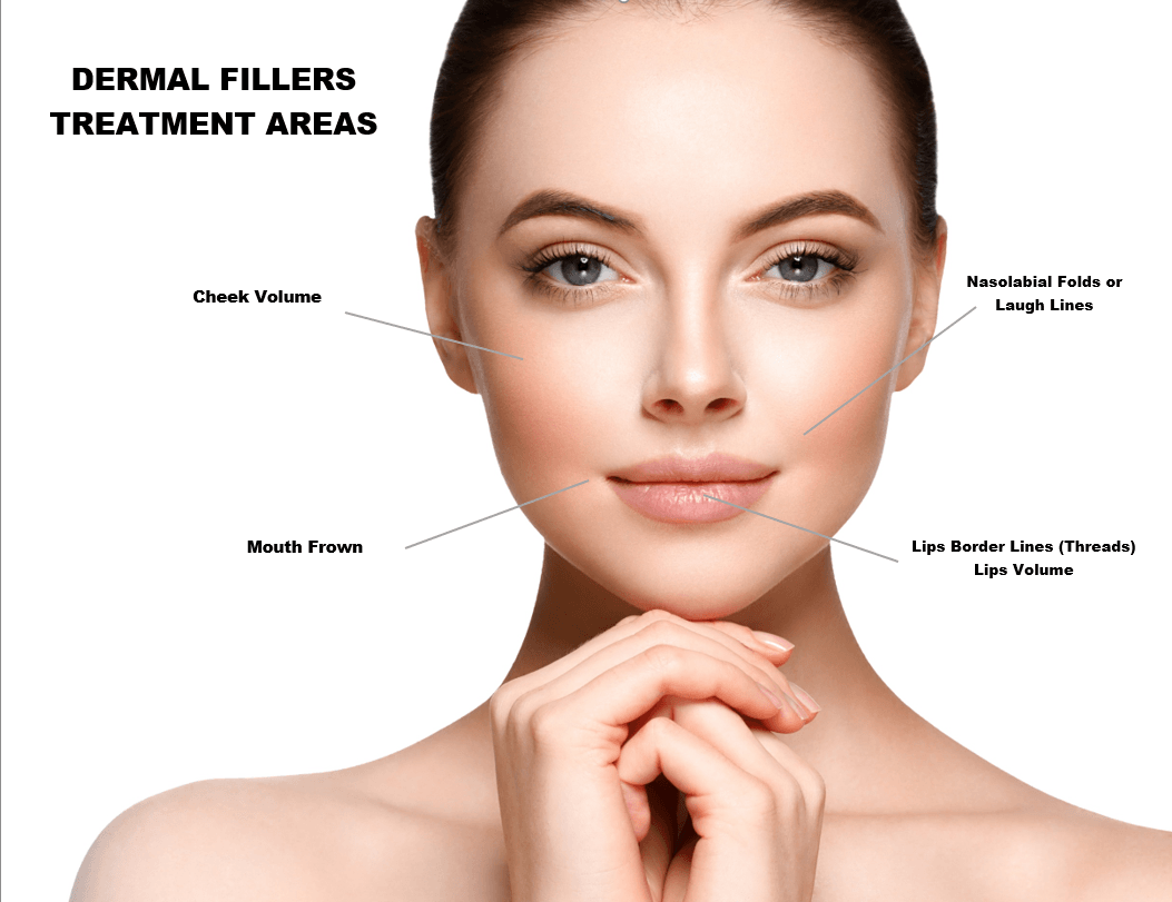 "Cosmetic Fillers in Pittsburgh, PA | Dental Spa"