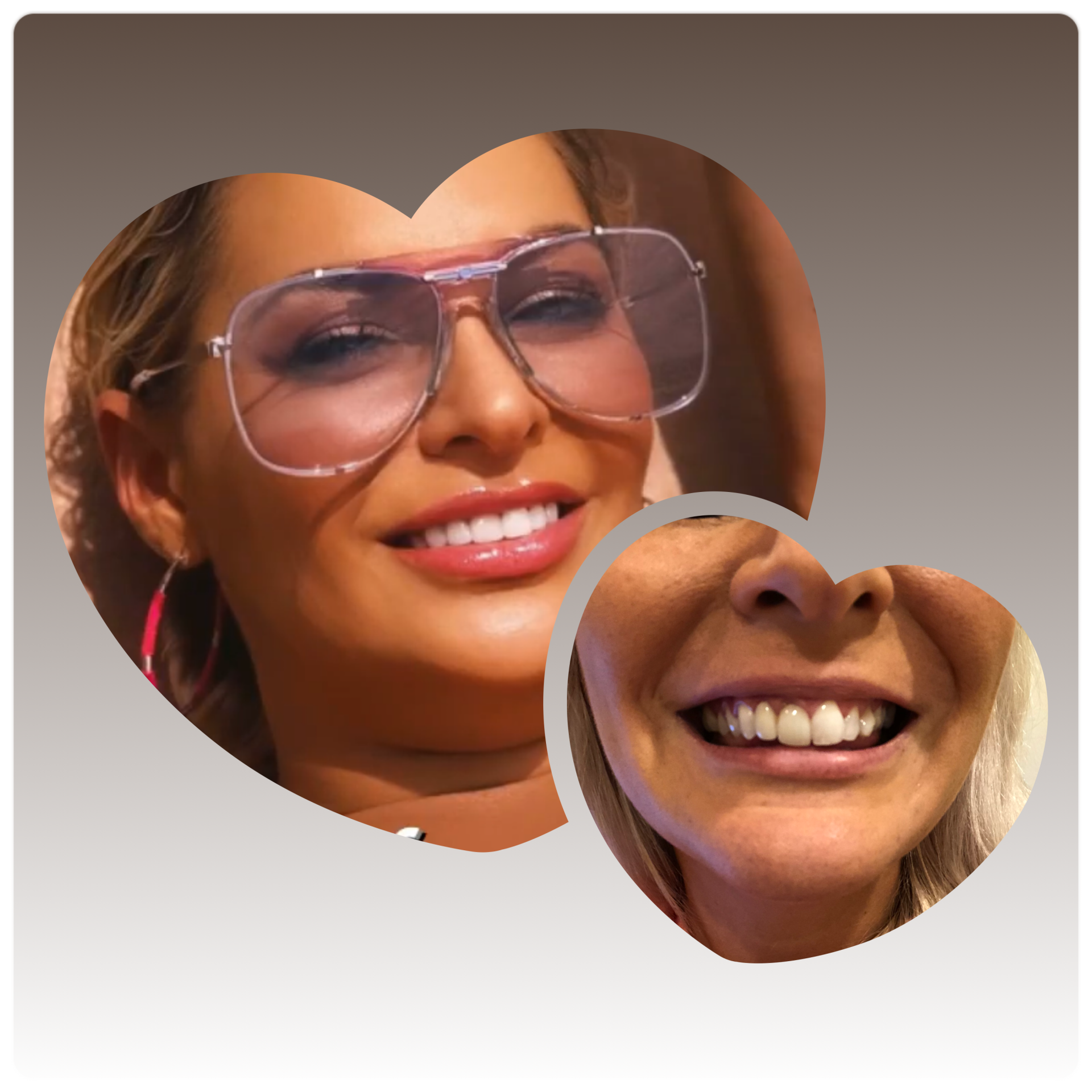 "Cosmetic Fillers in Pittsburgh, PA | Dental Spa"