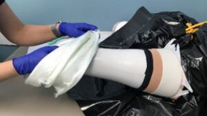 The Direct Socket: The science behind