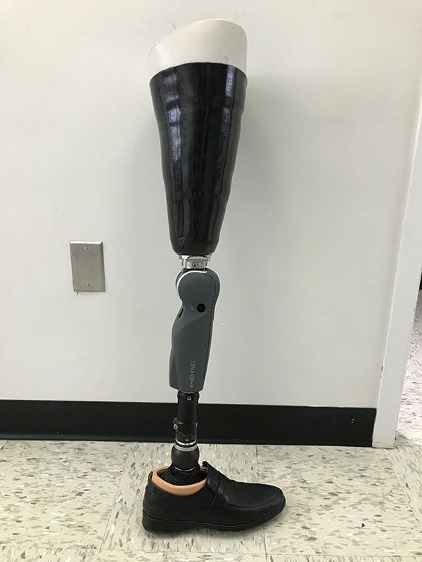 Direct Socket Leg Prosthetics | Infinite Technologies