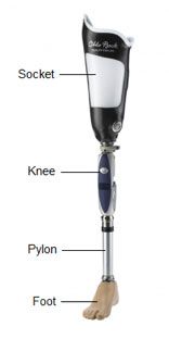 Above Knee Leg Prosthetics | Infinite Technologies