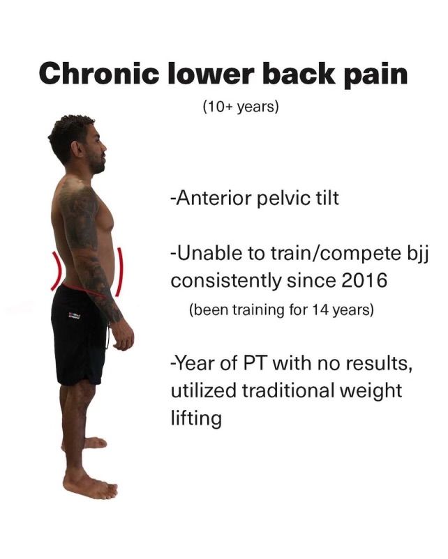 AZ Functional Patterns Back Pain Relief Client Testimonial