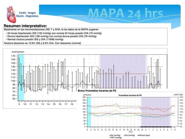 Estudios de cardiología en CDMX – CARDIO IMAGEN