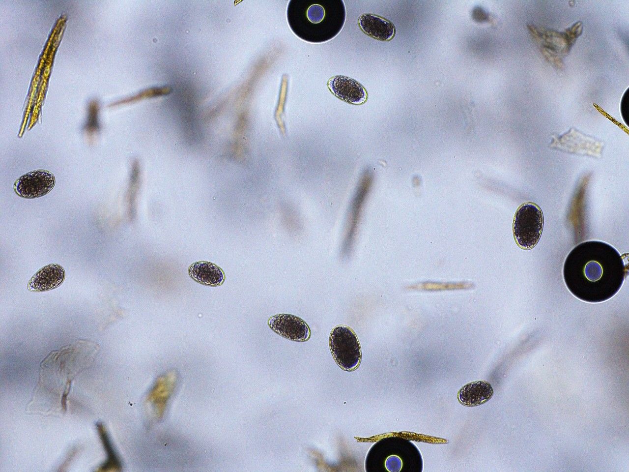 ParaBoss WEC QA Certified Lab | GYST Livestock Parasitology