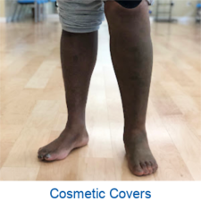 Silicone Prosthetic Skins NYC & Long Island | Custom Covers