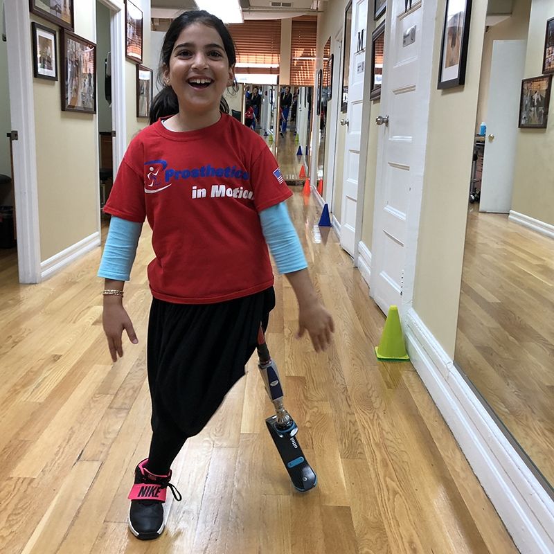 Pediatric Prosthetics Gallery | Prosthetics in Motion