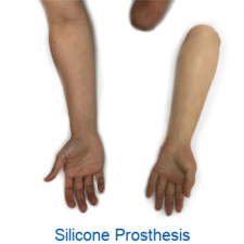 Silicone Prosthetic Skins NYC & Long Island | Custom Covers