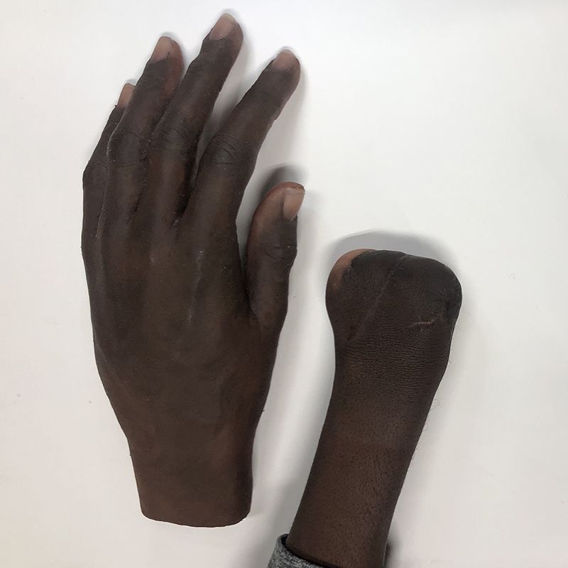 Prosthetic Silicone Skins Gallery | Prosthetics in Motion