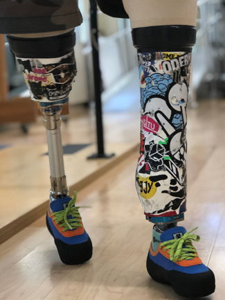 Sports Prosthetics NYC & Long Island | Running, Cycling & More
