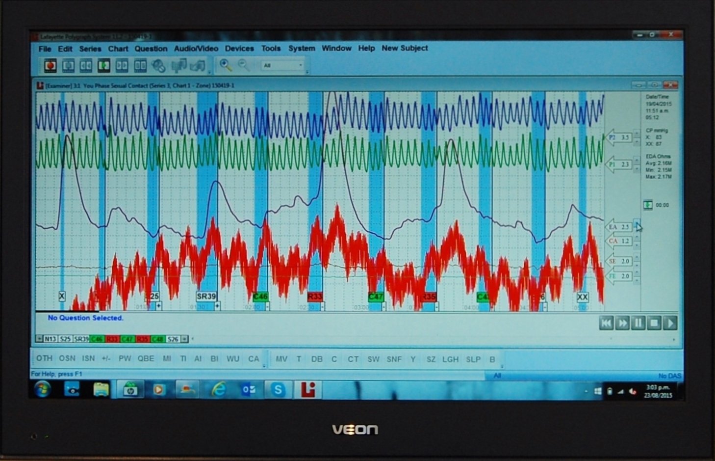 Lie Detector New Zealand |Polygraph | New Zealand