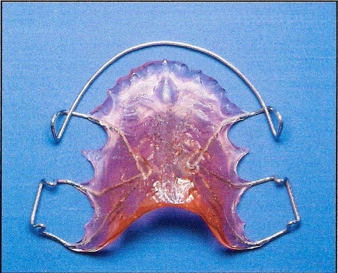 Custom Dental Retainers | Perth, WA | Orthoshop Orthodontic