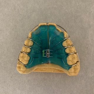 Custom Orthodontic Appliances | Perth, WA | Orthoshop