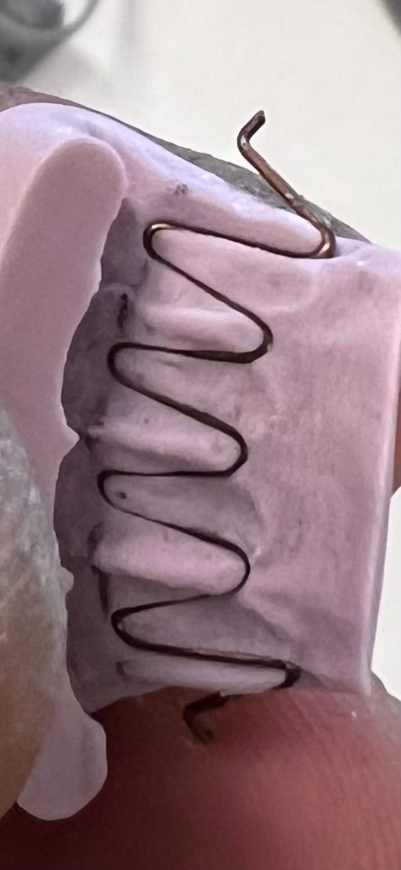 Custom Dental Retainers | Perth, WA | Orthoshop Orthodontic