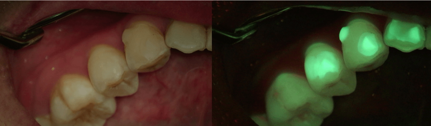 Smile Design Dental Pracitce | Microscopic Dentistry