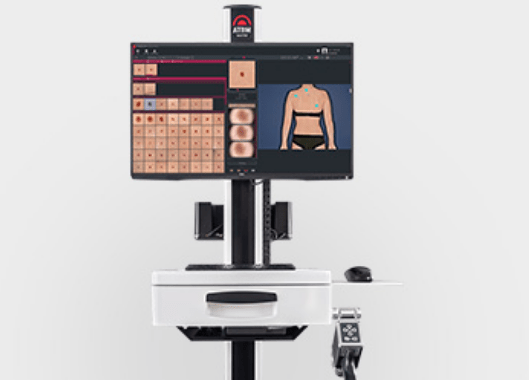 Mole Mapping: Early Detection for Skin Health | Derm.ca