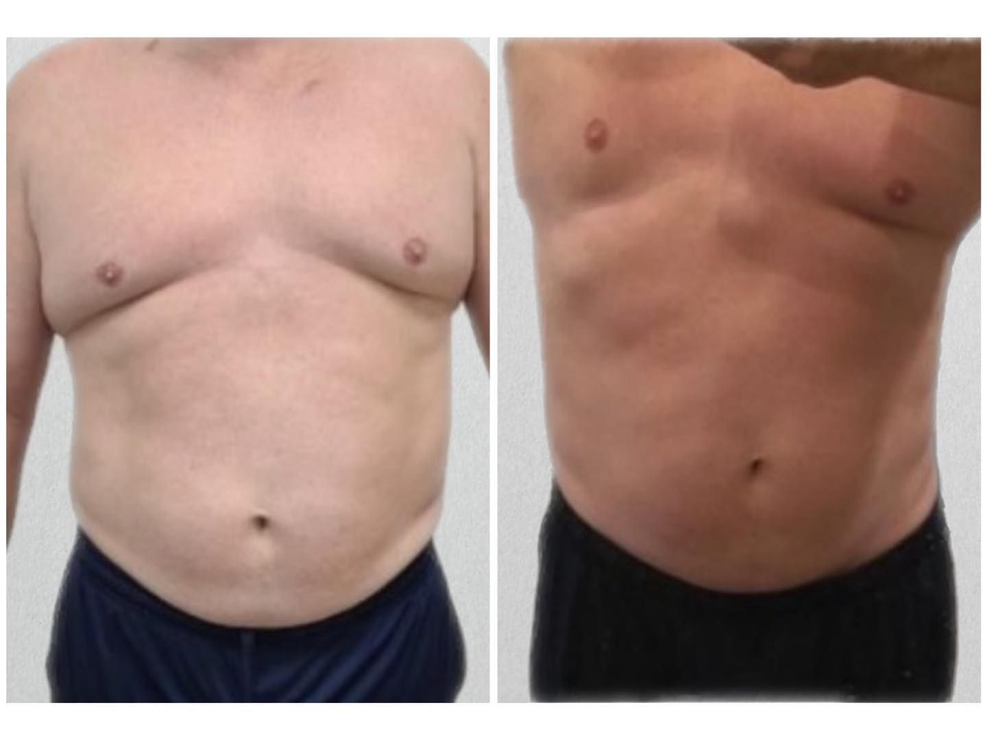 Balanced Beauty: Medical + Wellness Spa | Finger Lakes' Spa in Geneva