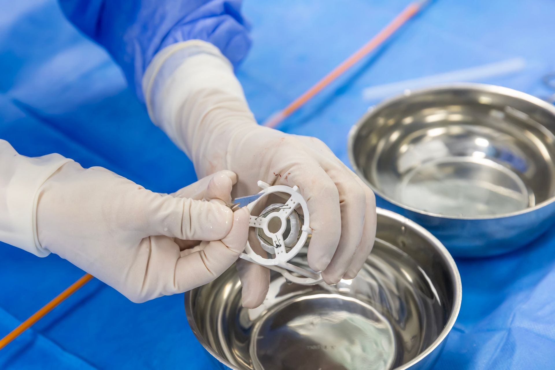 Avanços na Cardiologia: O Papel Transformador da TAVI no Tratamento da ...