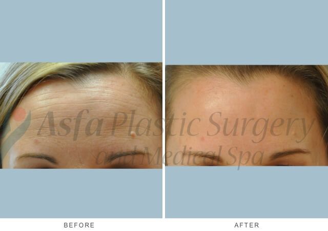 Asfa Plastic Surgery