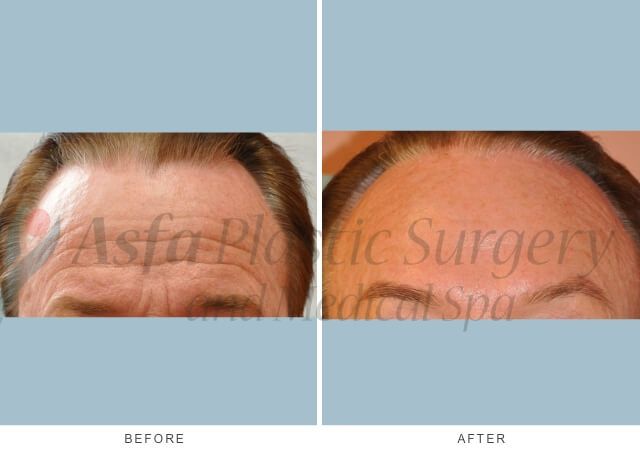 Asfa Plastic Surgery