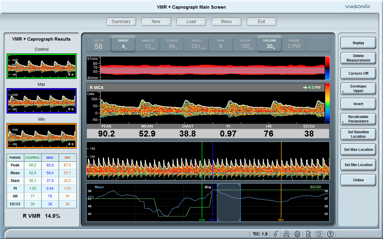 Dolphin Transcranial Doppler Systems | Medi Max Global