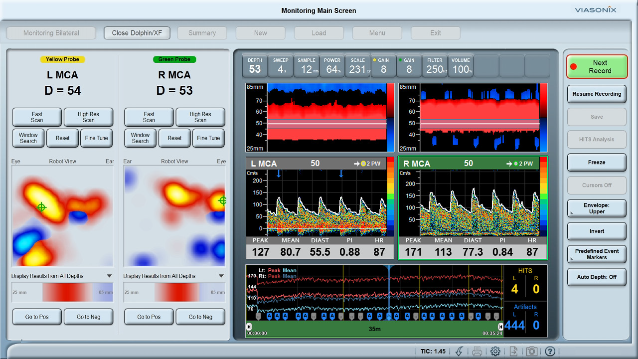 Dolphin Transcranial Doppler Systems | Medi Max Global