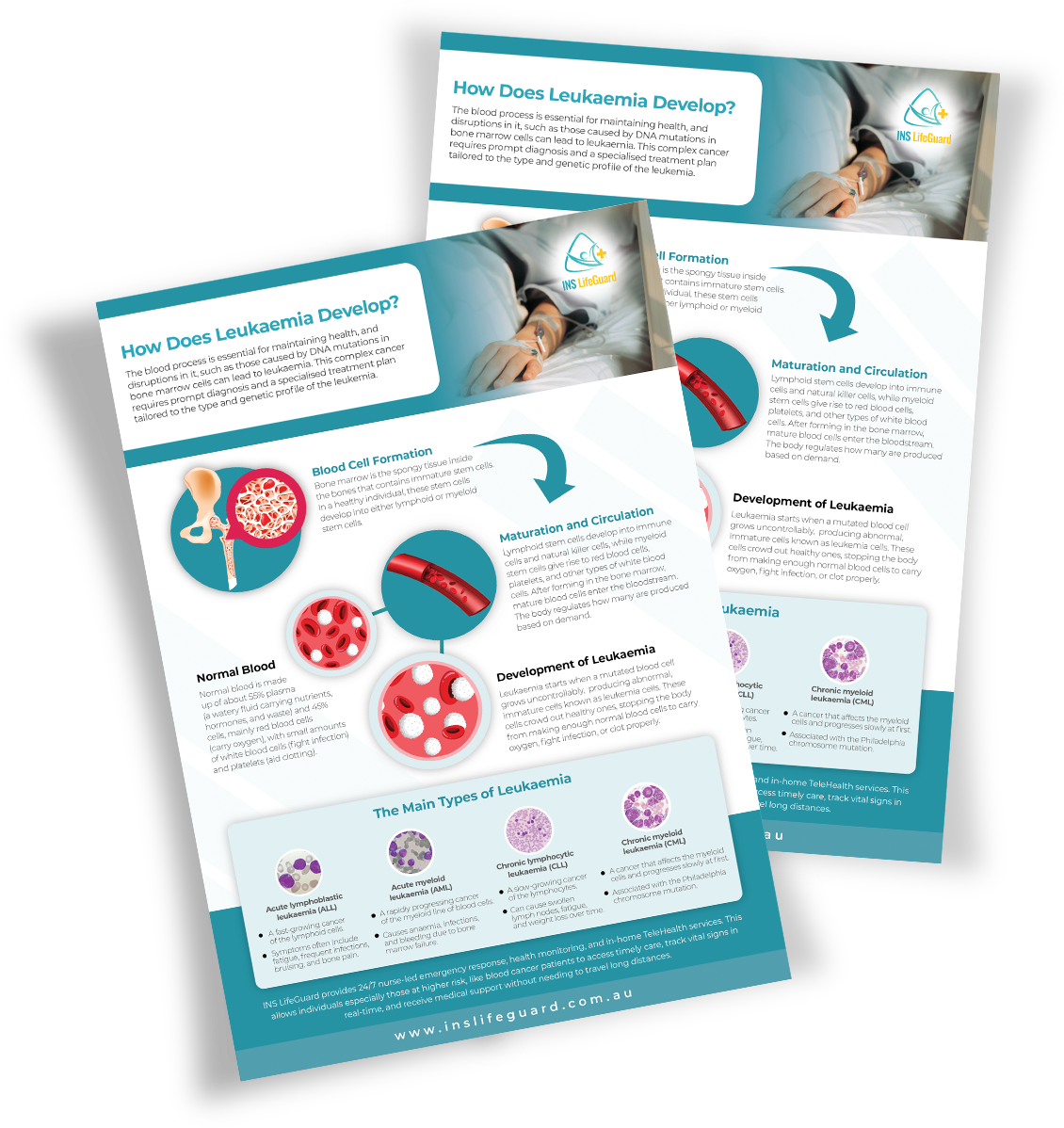 Leukaemia Explained: Key Symptoms, Diagnosis & Treatment Options