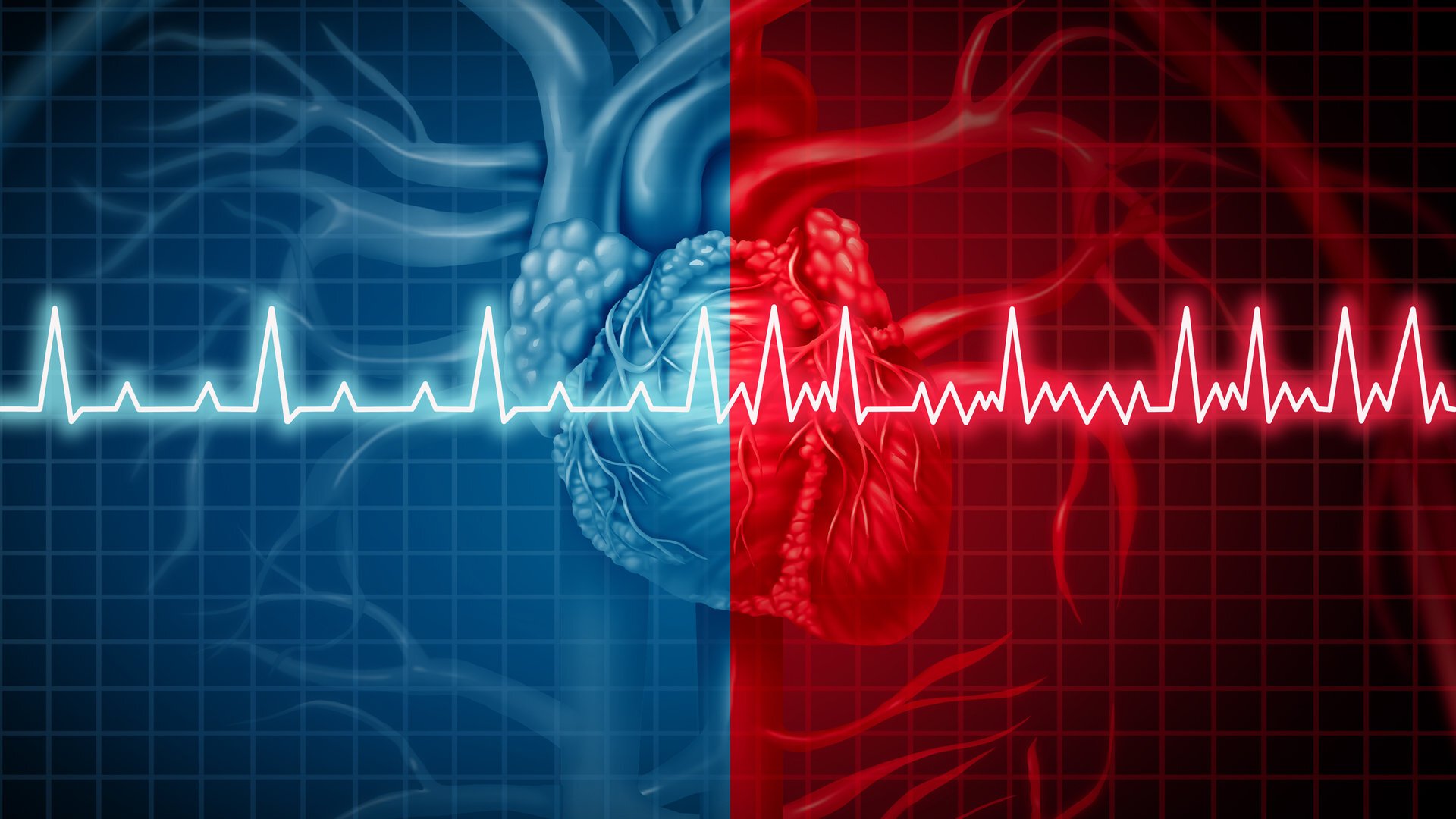 What Is an EKG & Why Might a Doctor Request One?