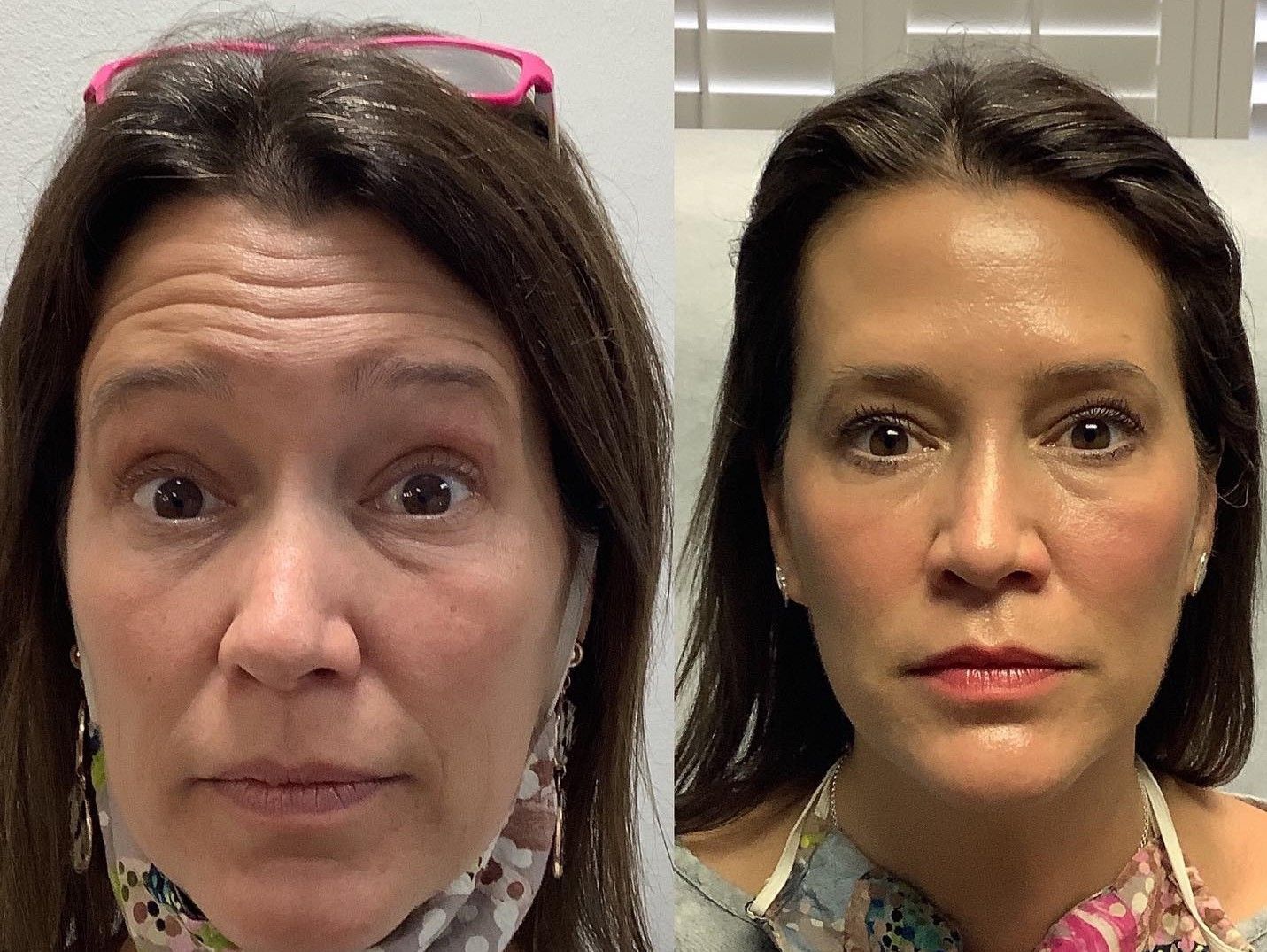 Patient Gallery – Jacksonville, FL – Ponte Vedra Vein Institute