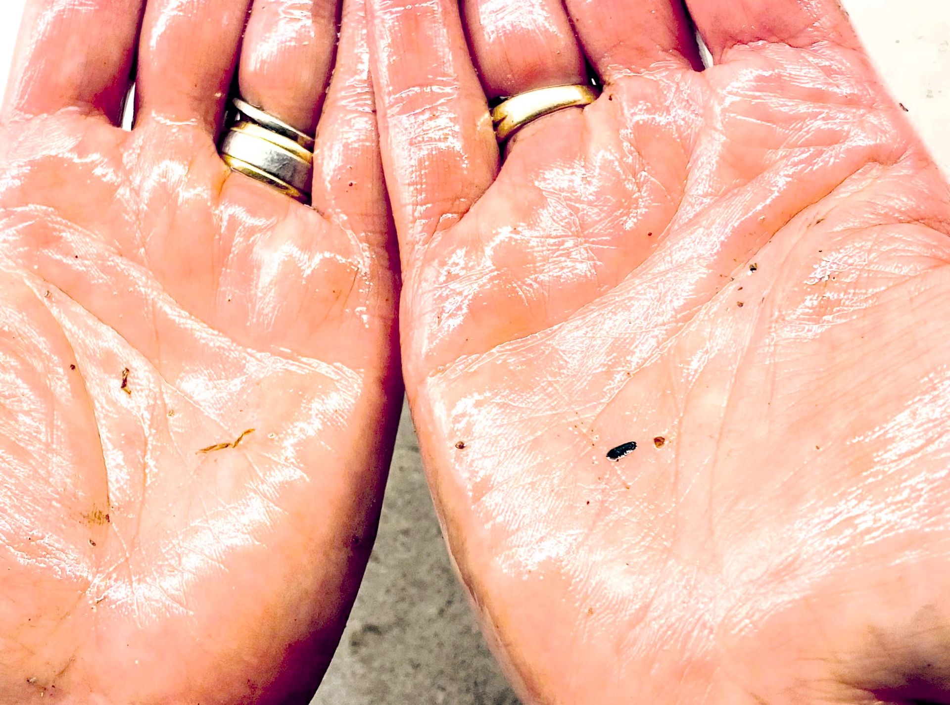 Safe & Simple Ways to Remove Tree Sap from Your Hands Fast