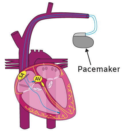 Heart Electrical System Anatomy and Sequence of Electrical Conduction