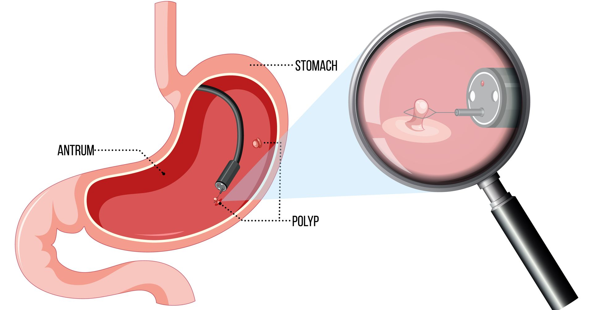 The GI Center | Gastroenterology Clinic in Cypress, TX