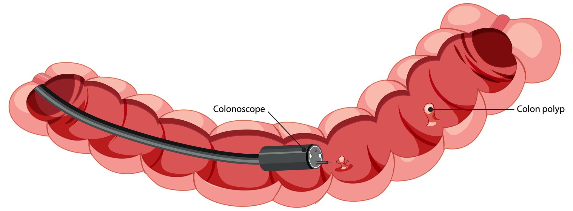 The GI Center | Gastroenterology Clinic in Cypress, TX