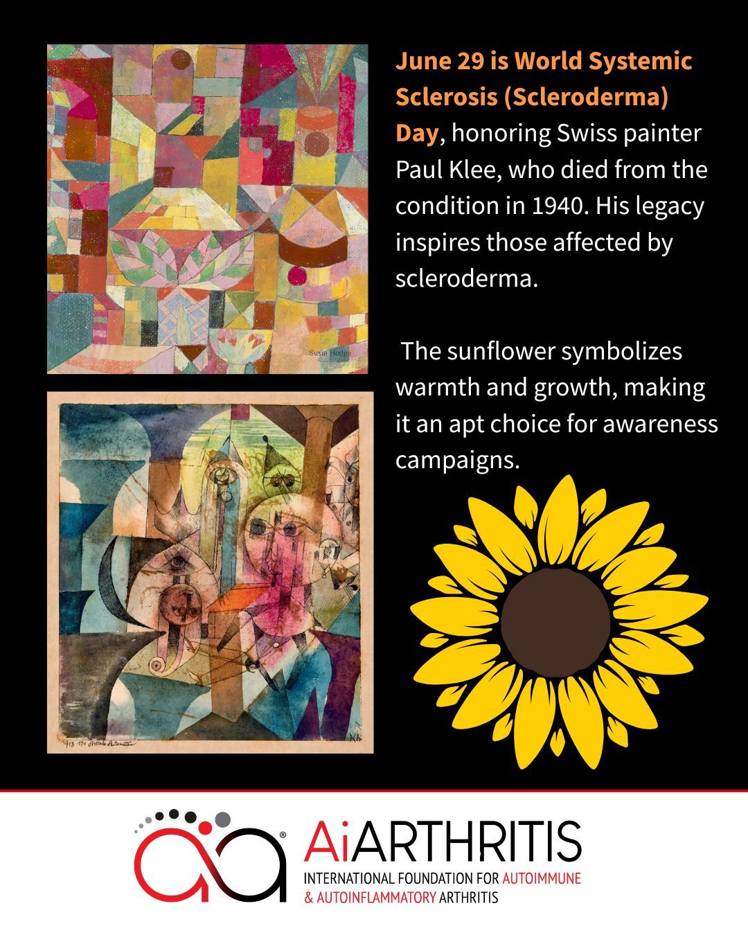 June 29: World Systemic Sclerosis (Scleroderma) Day