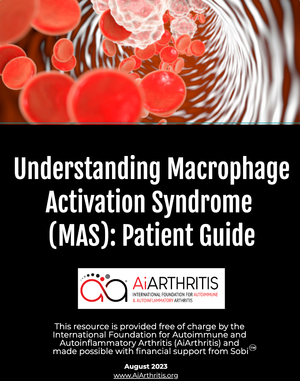 Macrophage Activation Syndrome (MAS)