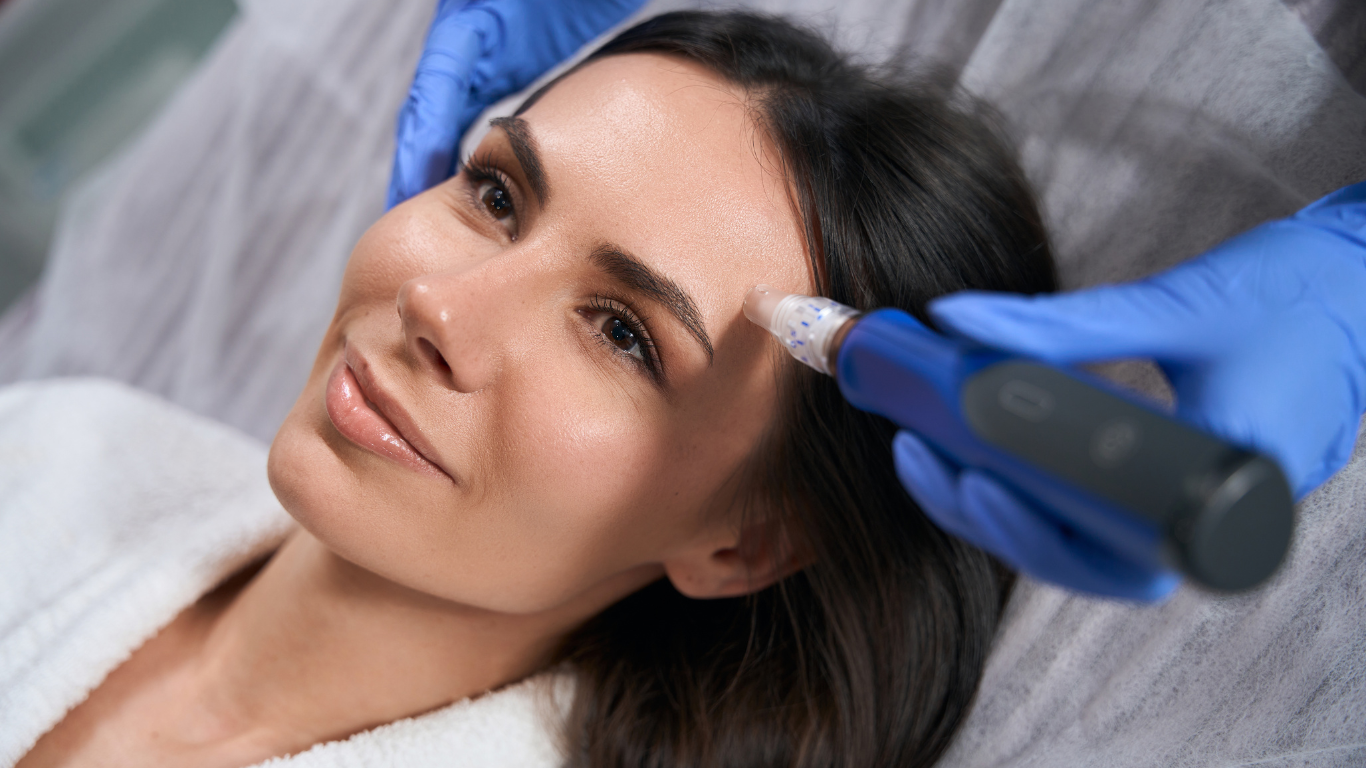 Microneedling | 9317 Medical Office
