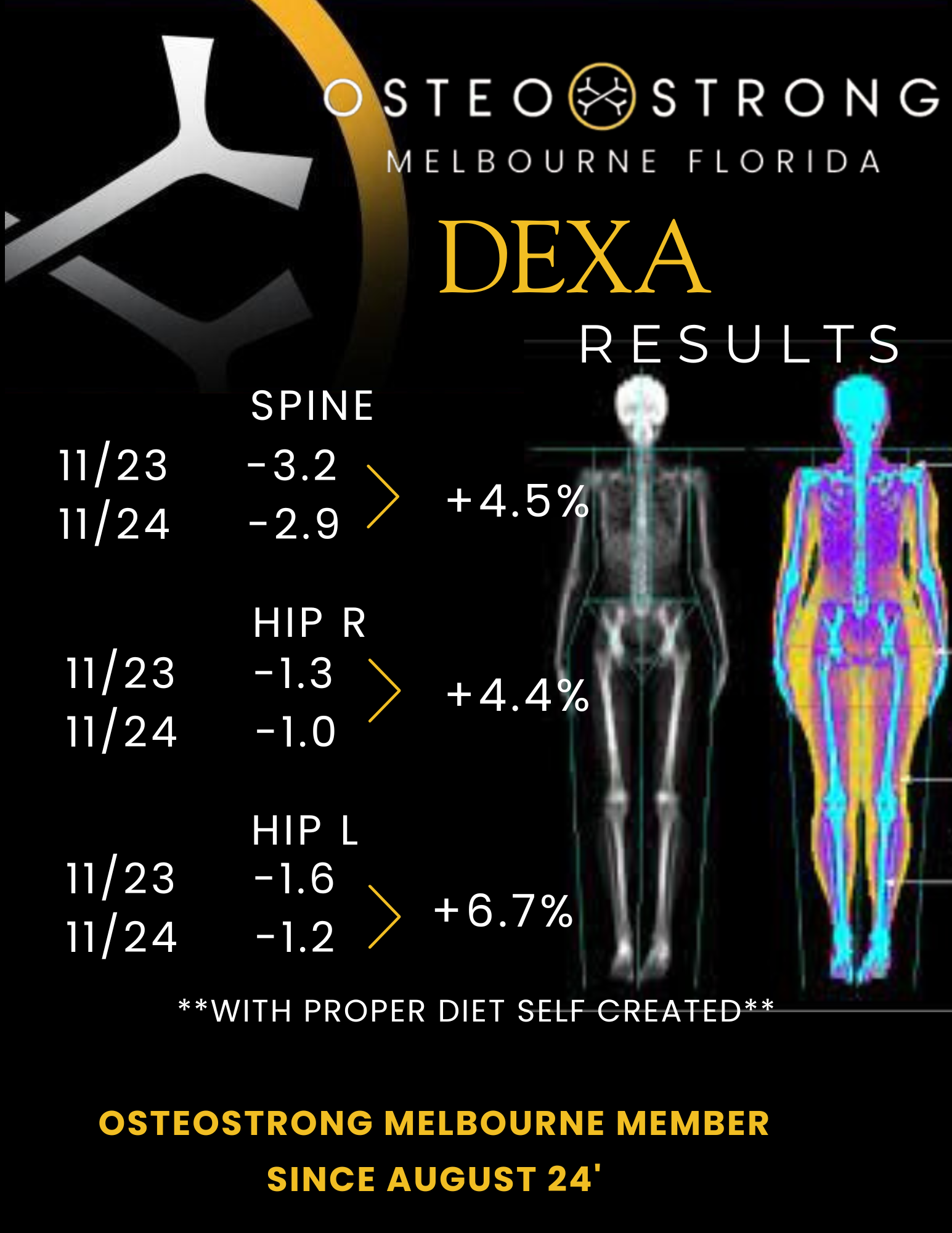 Osteoporosis Specialist Melbourne | OsteoStrong