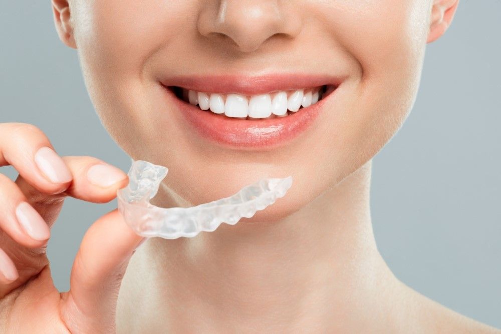 Invisalign Braces – Epsom & Newmarket | Belich Dental