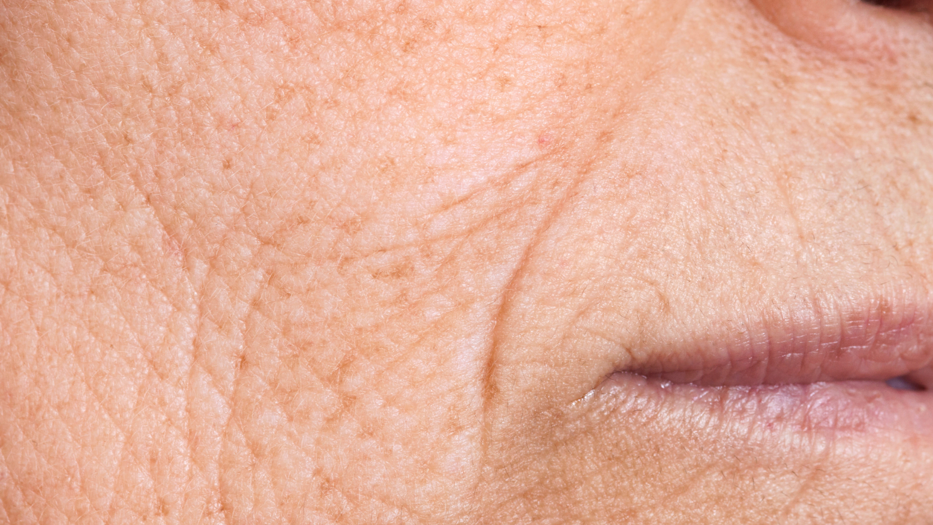 Unlocking the Secrets: What Microneedling Does for Your Skin
