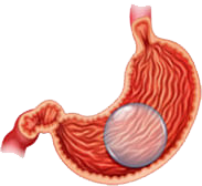 Gastro SB Clinic - GI & Nutrition Experts in Chula Vista