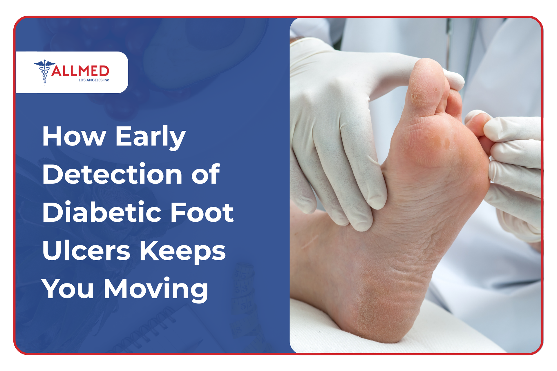 Diabetic Foot Ulcer Prevention Through Early Detection