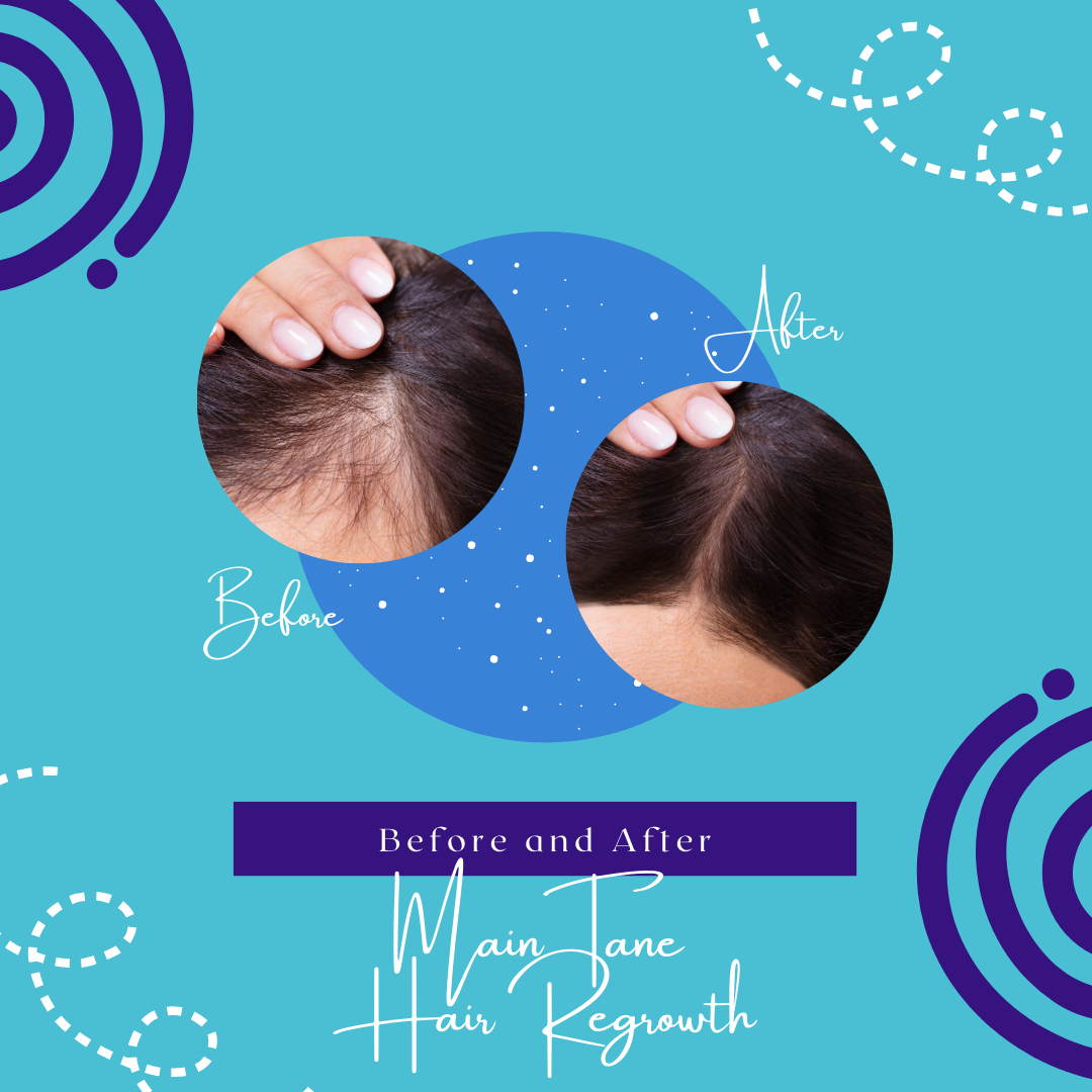 ManeTain Leave-In Spray: The Ultimate Solution for Hair Growth & Retention