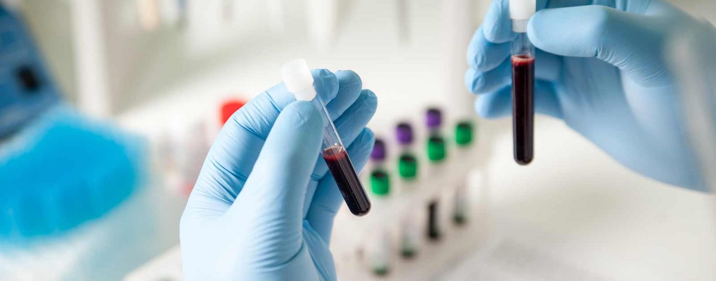 Home ∙ ACTA2 Alliance ∙ Foundation for Multisystemic Smooth Muscle ...