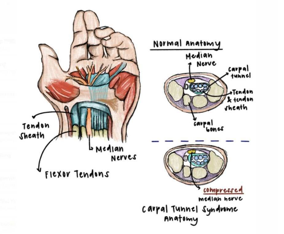 Chiropractic Care For Carpal Tunnel Syndrome - One Spine