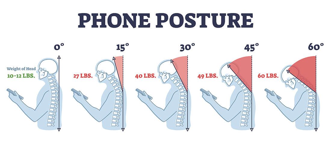 What is text neck? Symptoms and what you can do about it