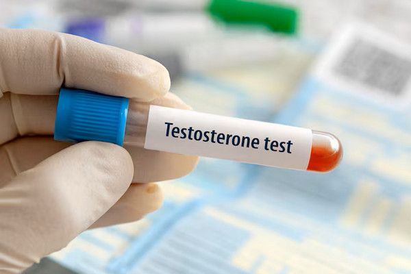 Testosterona baja: principales síntomas y cómo combatirla