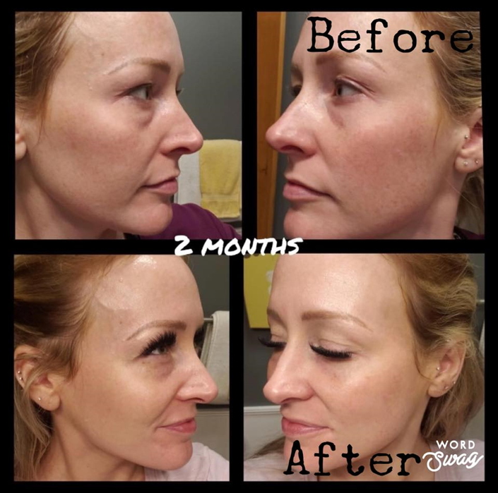 Seeing is Believing: Before & After TrūAura Skincare Products