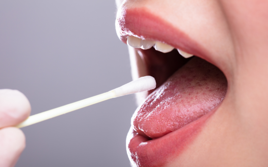 O que é Boca Seca e qual pode ser a Causa?