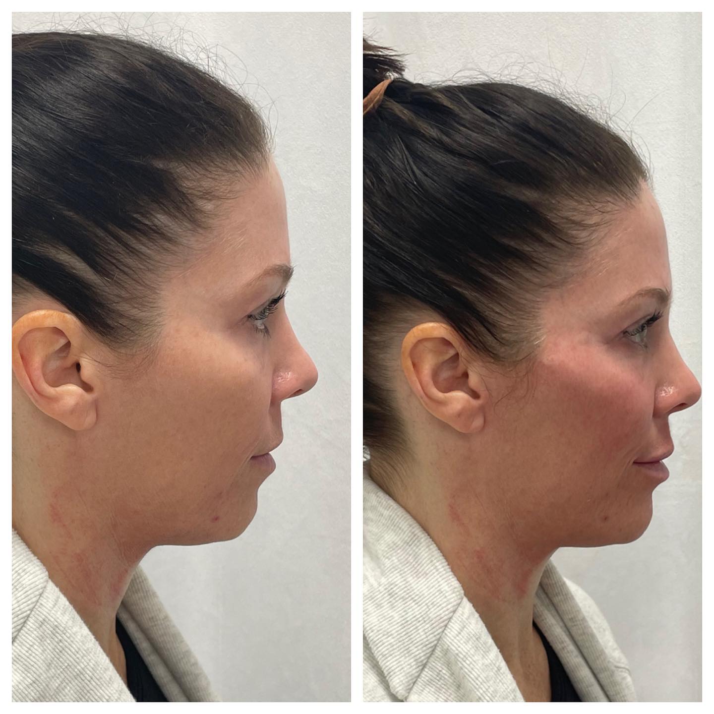 View Our Gallery | Casper, WY | Pretty Please Aesthetics