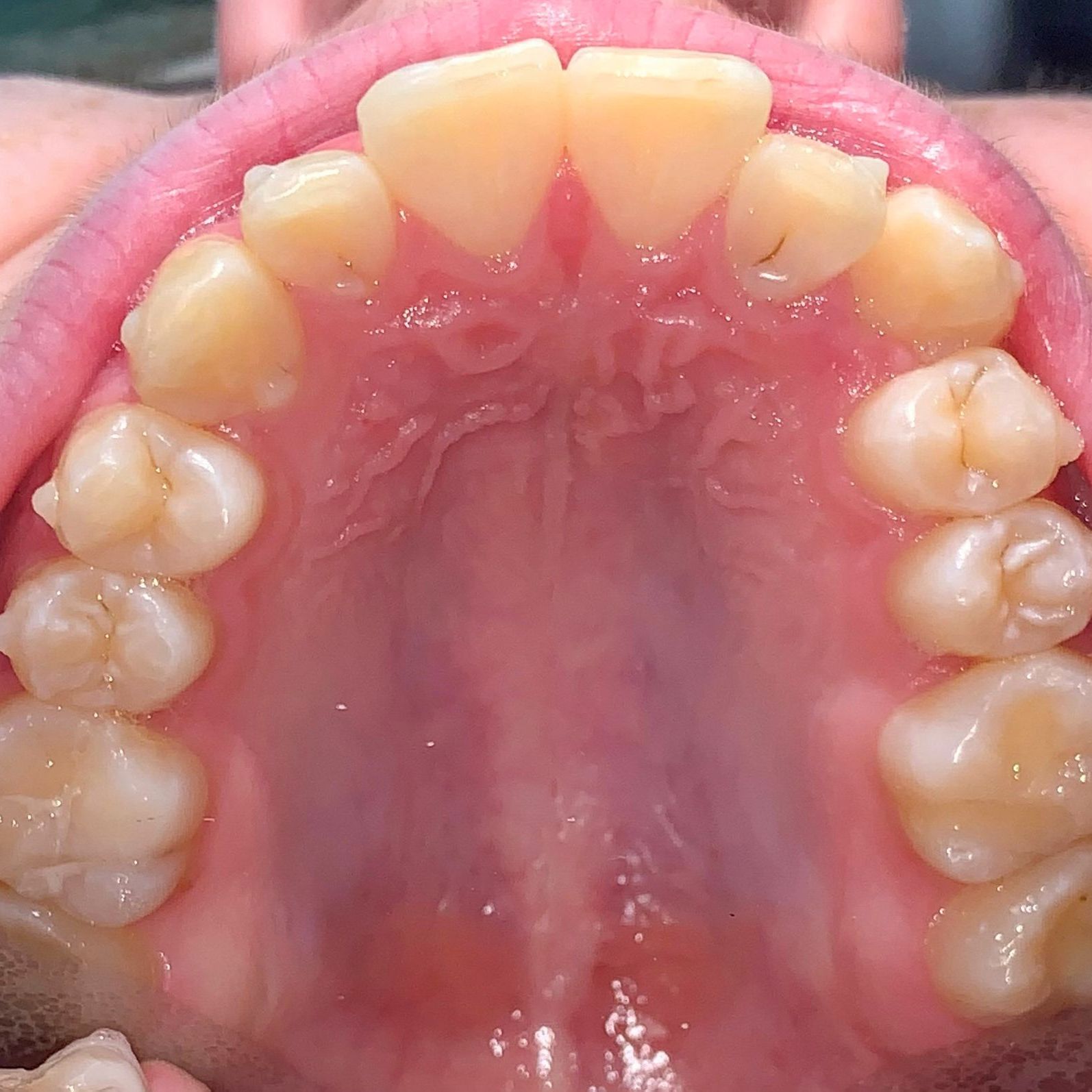 Vivos® DNA Appliance® Provider - mRNA Appliance® - Day And Night Device