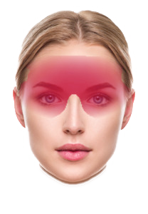 Types of Headaches | Fuller Sleep & TMJ Solutions | Greensboro, NC